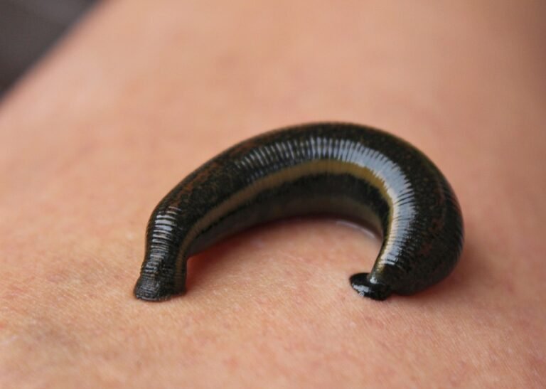 Chinese Man Hospitalised After Putting Live Leech Into His Bladder ...